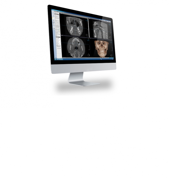 Rodenta: Radiologie Dentară Digitală Oradea